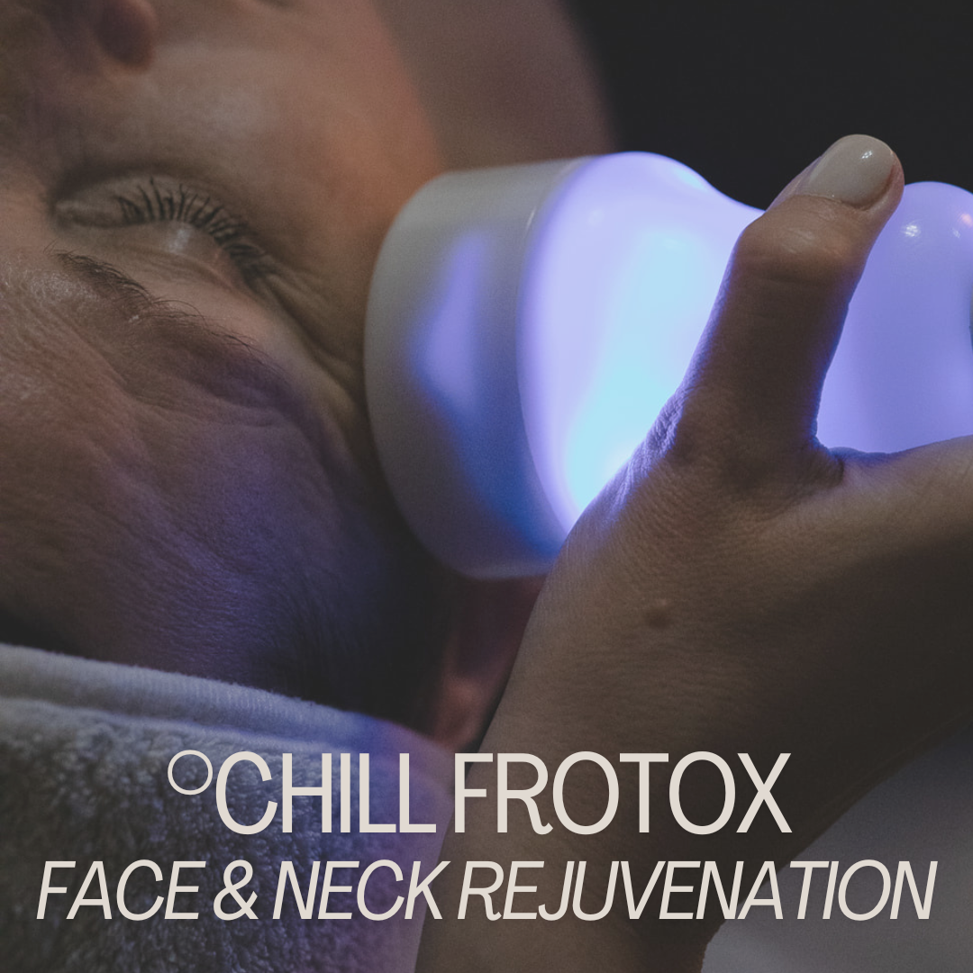 Frotox Face & Neck Rejuvenation | Chill Cryotherapy & Wellness